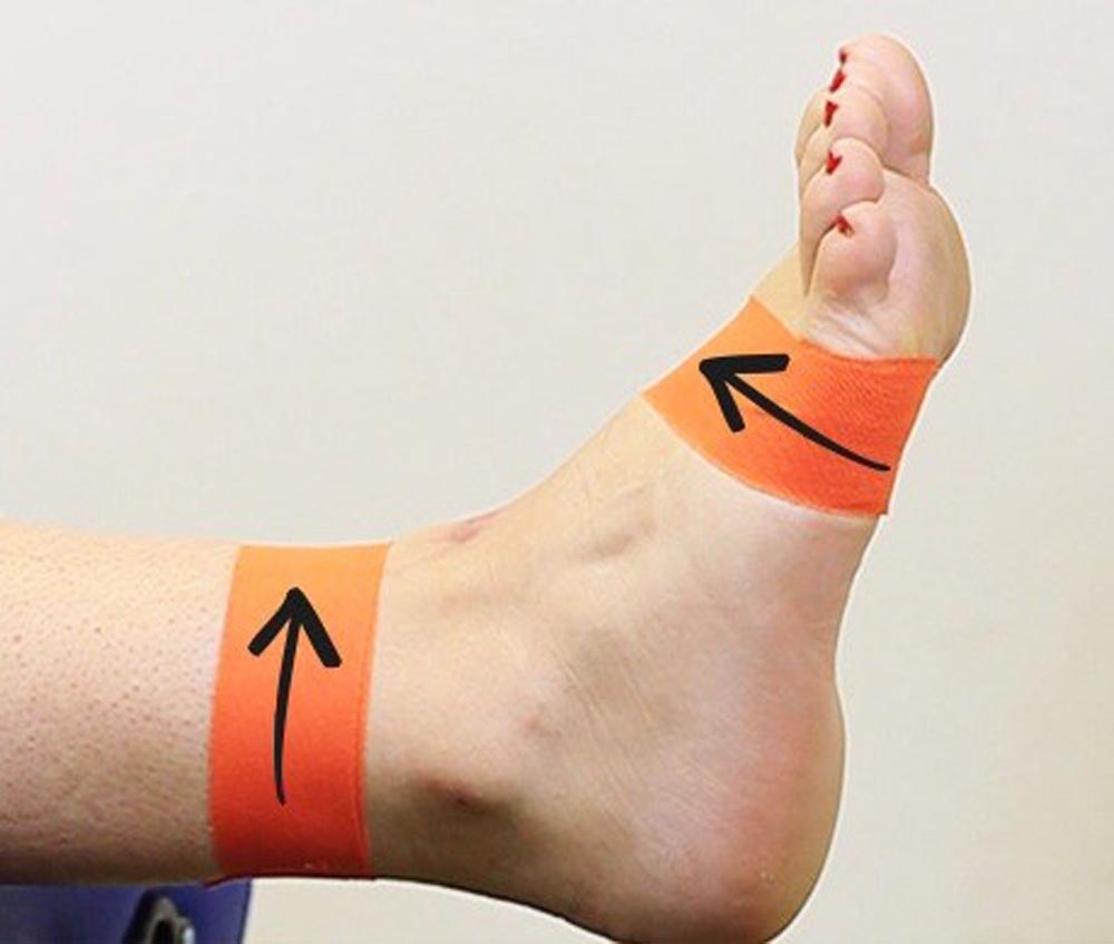 Top Ten Skills to Master for the Expedition Medic - Adventure Medic